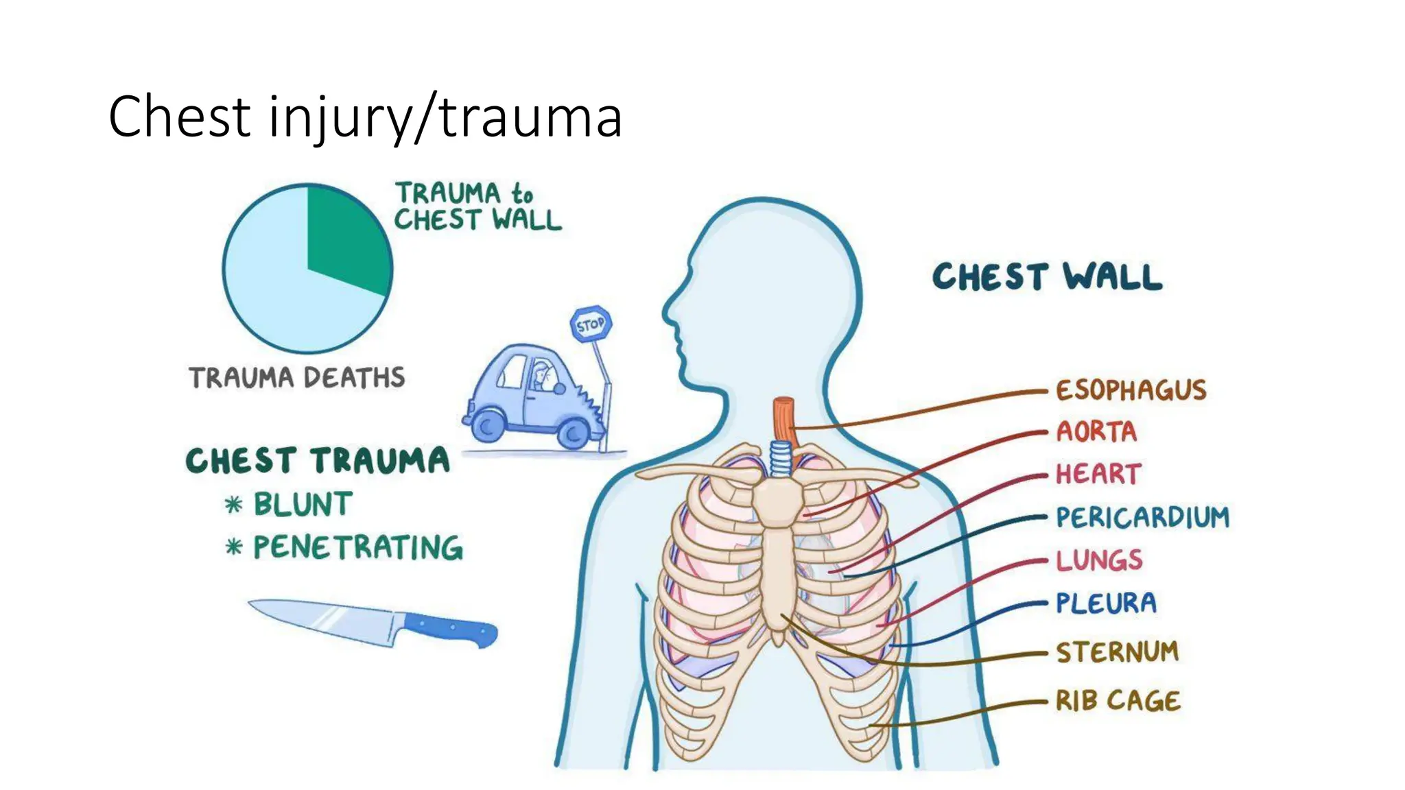 Chest Wall Surgery, Indications, Diagnosis, Management | PDF