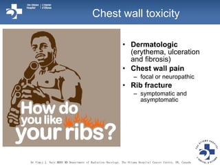 CHEST WALL TOXICITY IN SABR : PREDICTORS AND CONTOURING OF CHEST WALL | PPT