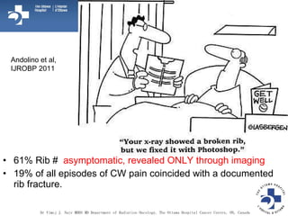 CHEST WALL TOXICITY IN SABR : PREDICTORS AND CONTOURING OF CHEST WALL | PPT