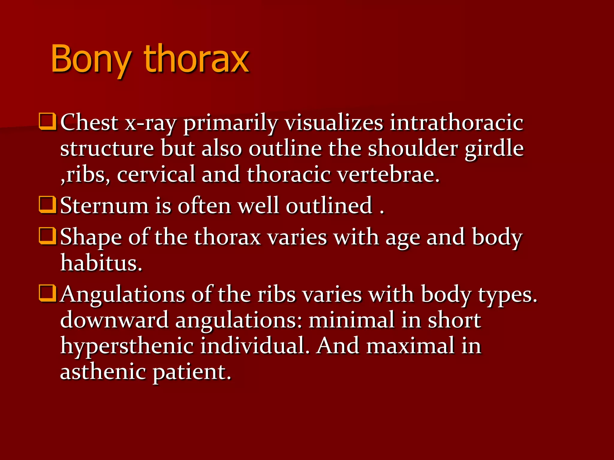 Chest x ray | PPT