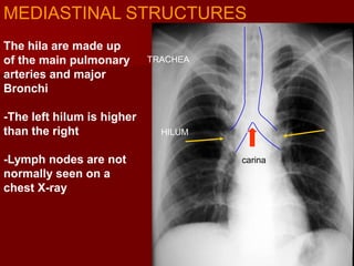 Chest x ray | PPT