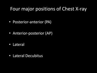 chestx-ray.pptx
