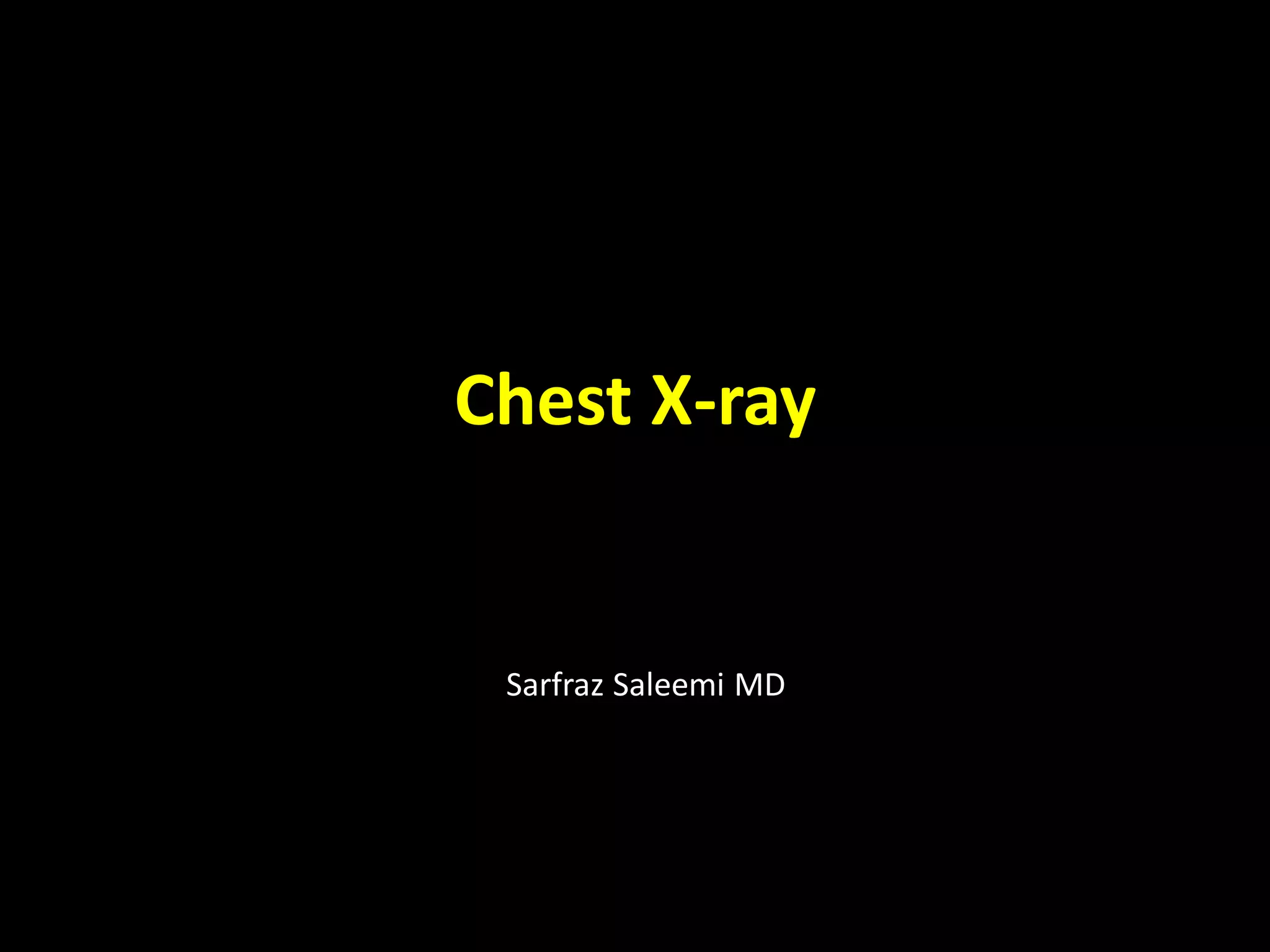 Chest X-ray Interpretation | PDF