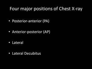 Chest X-ray Interpretation | PDF