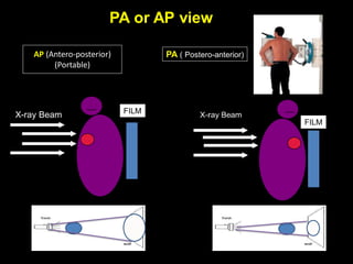 Chest X-ray Interpretation | PDF