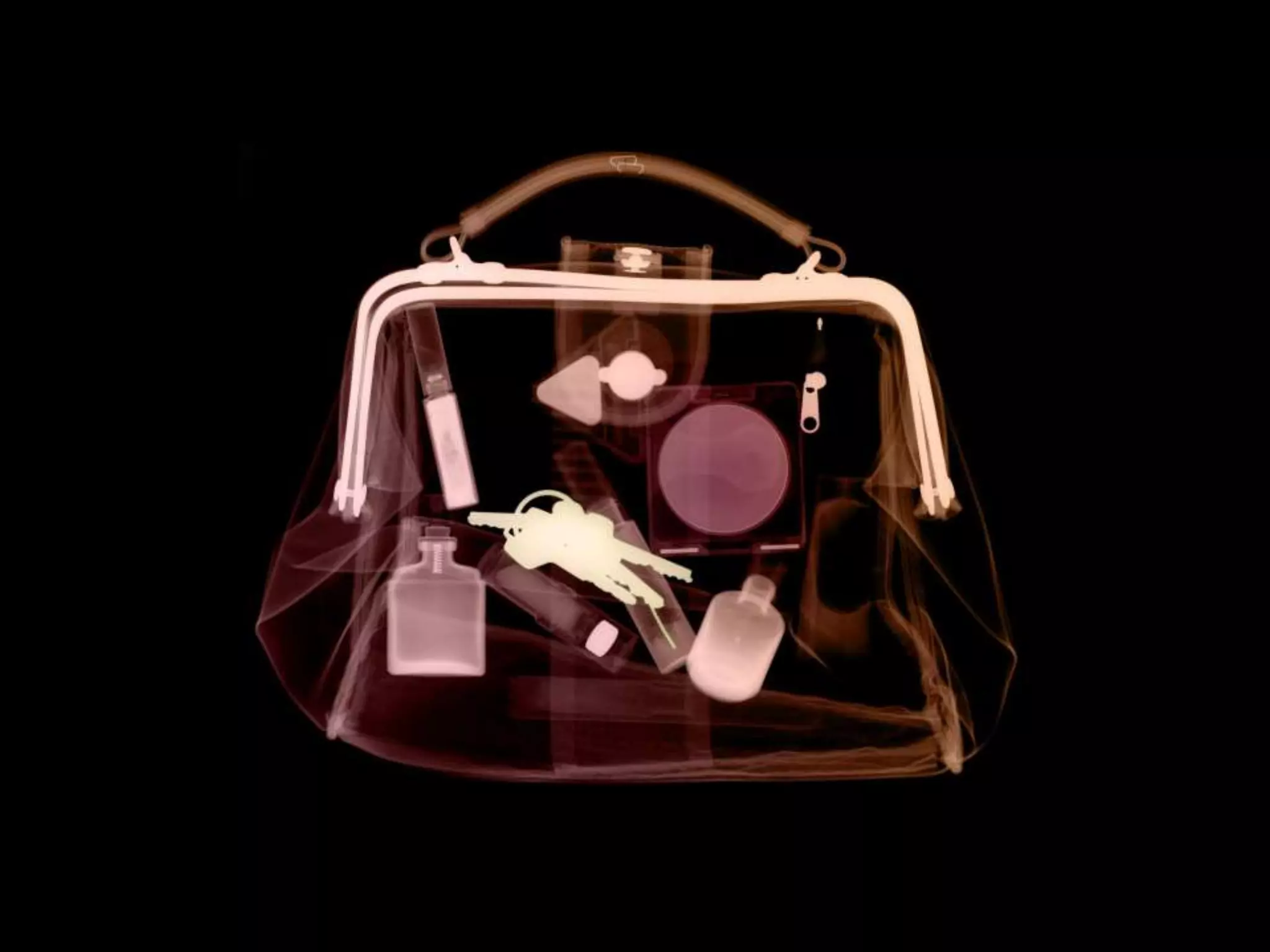 Chest x ray Interptetations | PPT