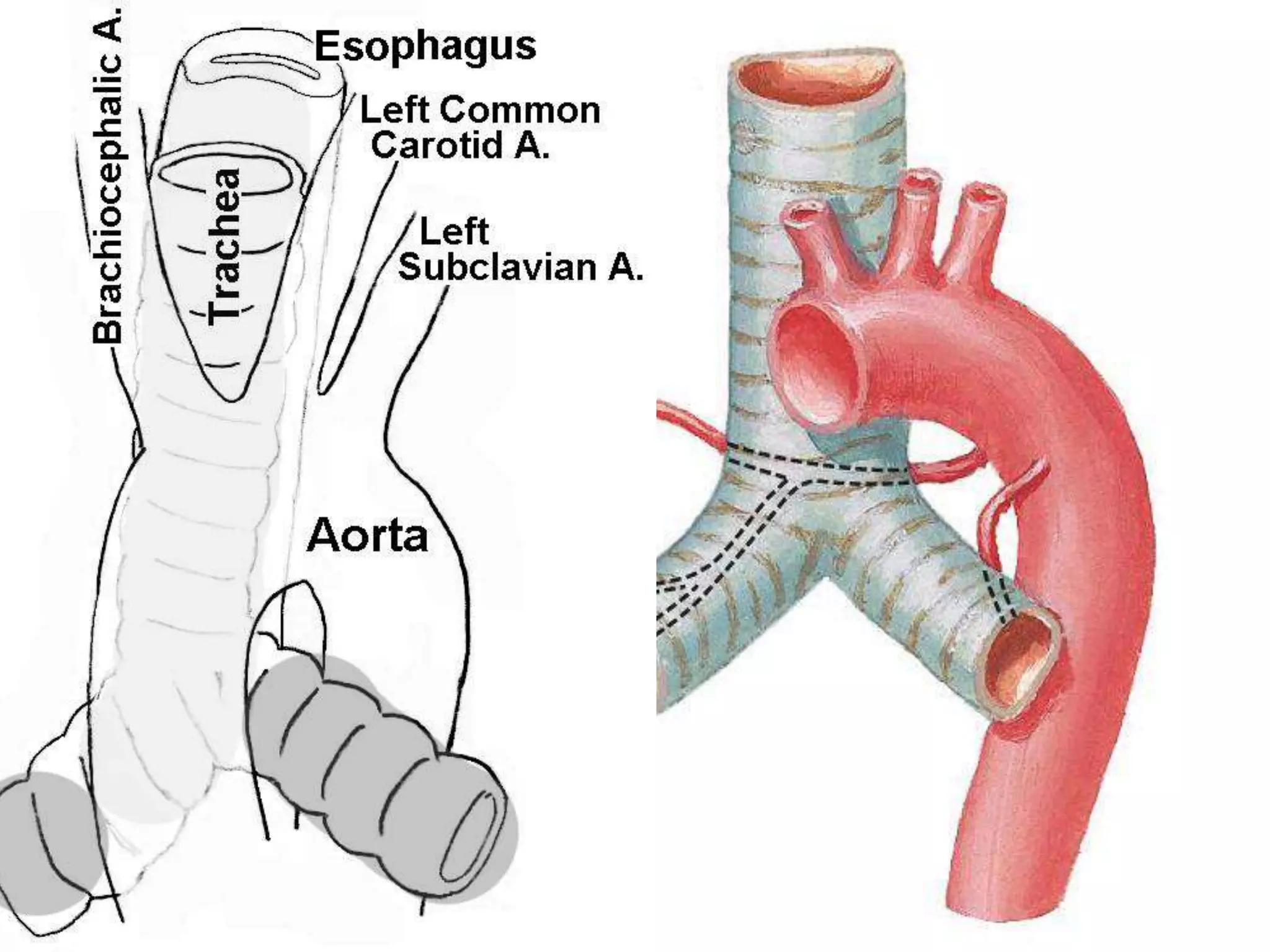 Chest x ray Interptetations | PPT