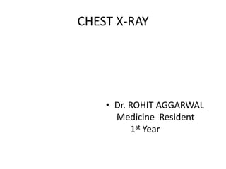 CHEST X-RAY.PPT.pptx