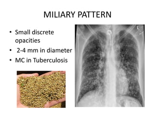 CHEST X-RAY.PPT.pptx