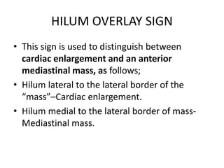 CHEST X-RAY.PPT.pptx