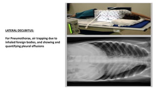 CHEST X-RAY.pptx