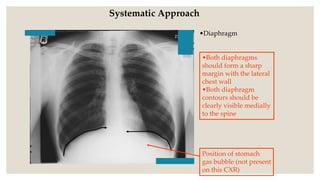 chest x-ray.pptx