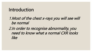 chest x-ray.pptx