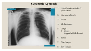 chest x-ray.pptx
