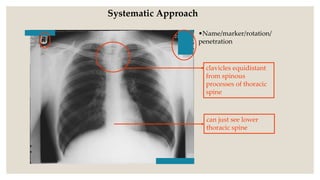 chest x-ray.pptx
