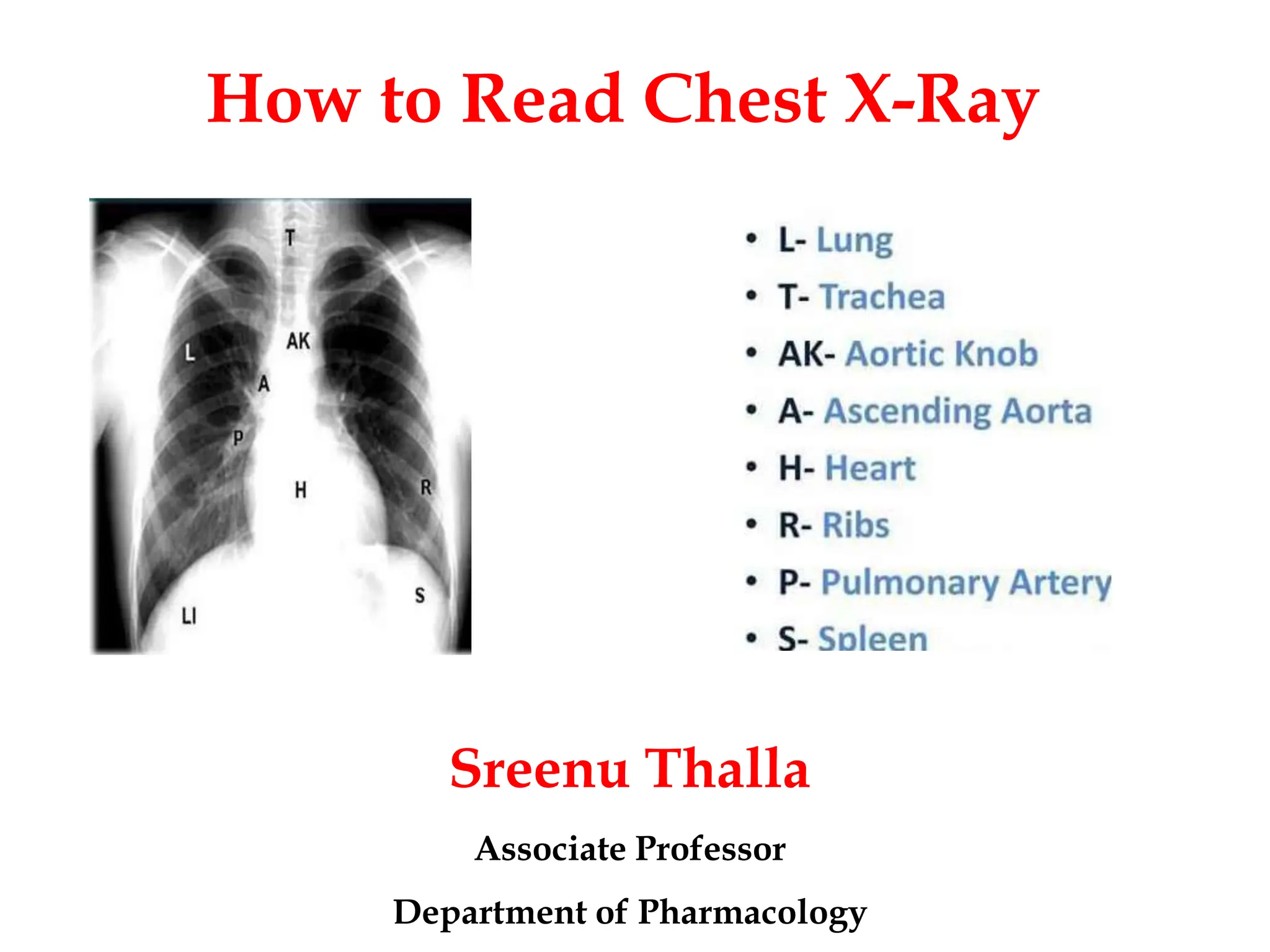 Understanding and Reading of Chest X-Rays | PPTX