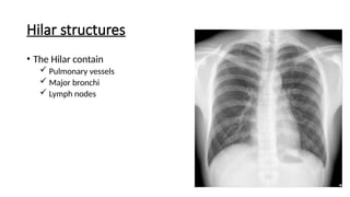 CHEST XRAY INTERPRETATION . A SLIDE IN CSH | PPTX