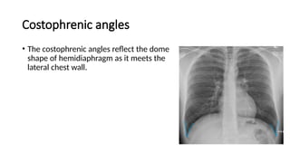CHEST XRAY INTERPRETATION . A SLIDE IN CSH | PPTX
