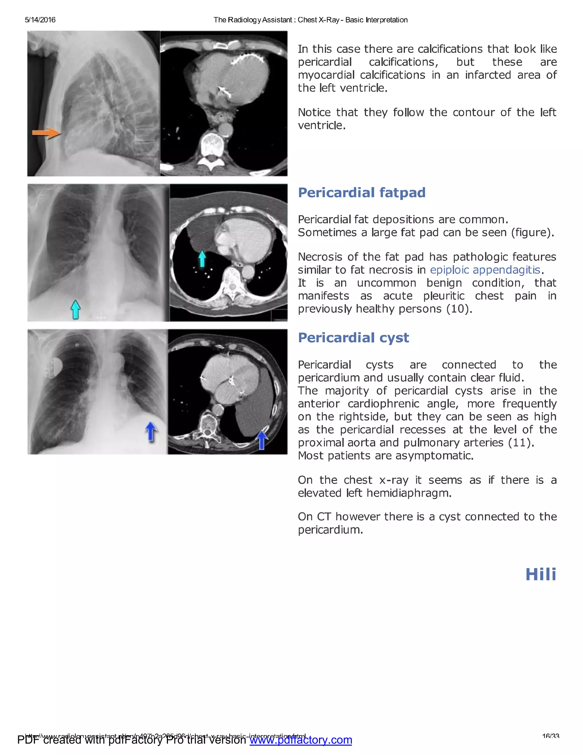 Chest x ray - basic interpretation | PDF