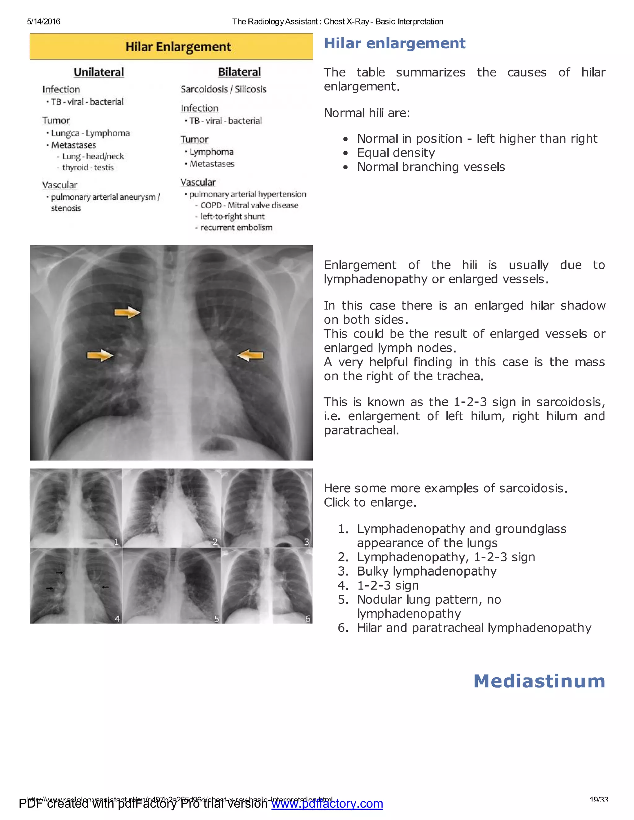 Chest x ray - basic interpretation | PDF