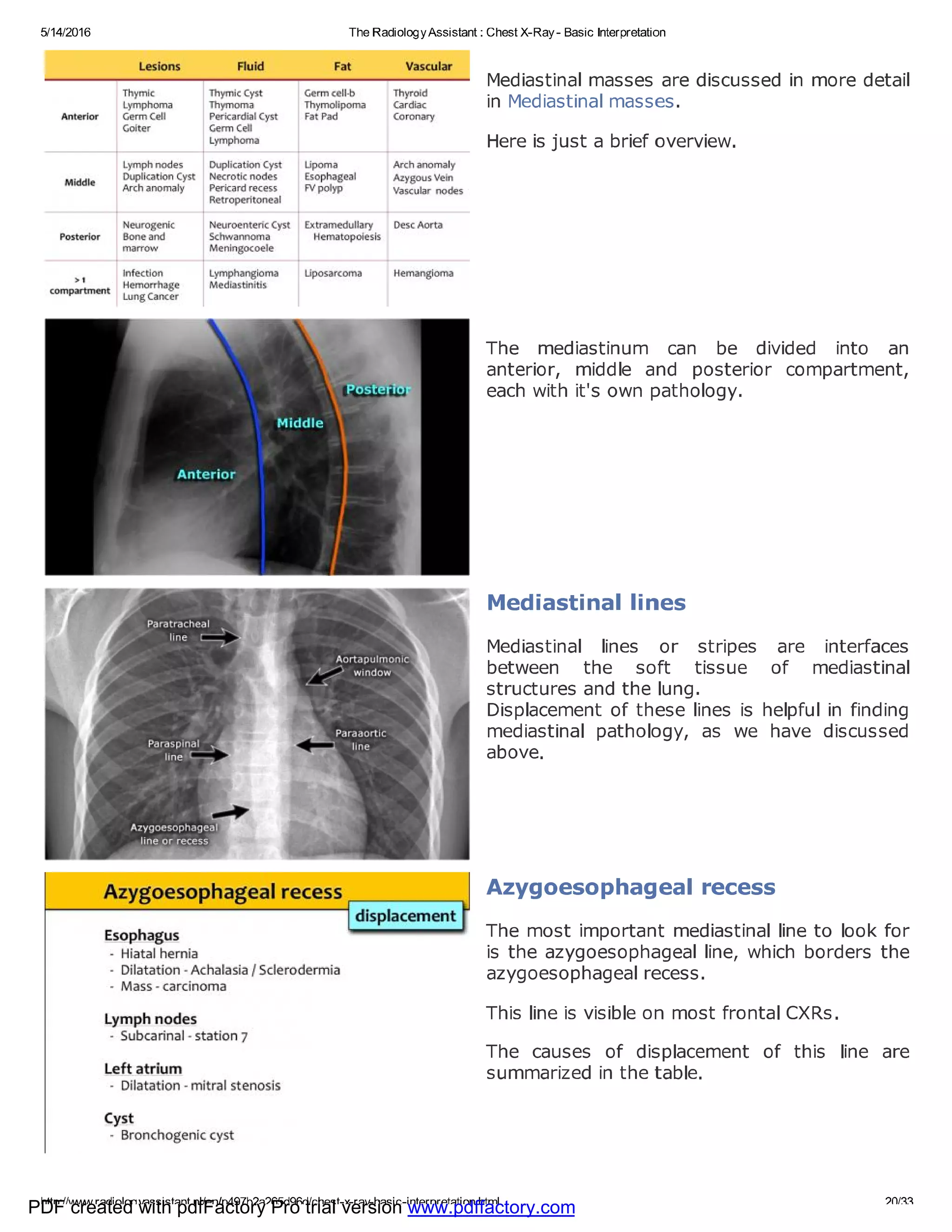 Chest x ray - basic interpretation | PDF