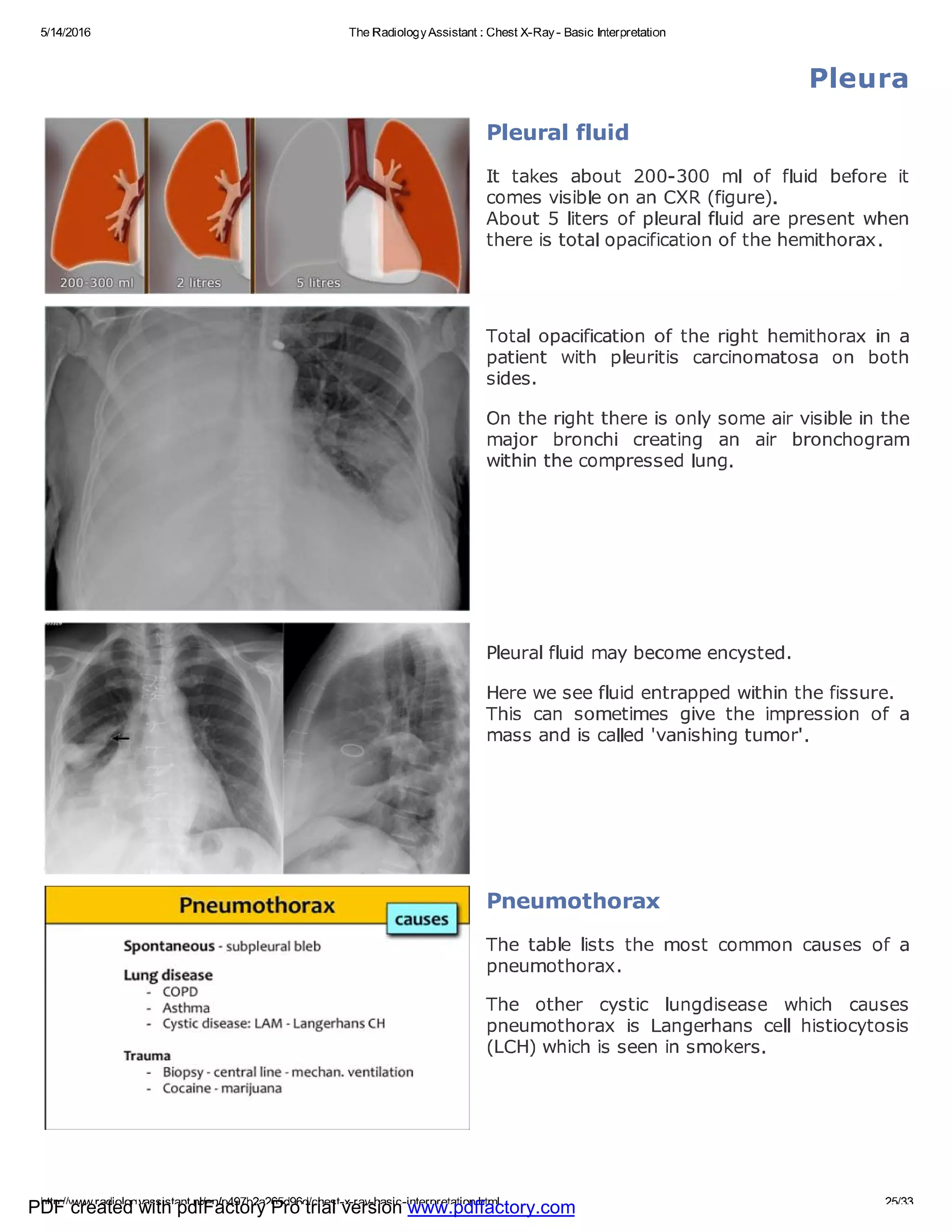 Chest x ray - basic interpretation | PDF