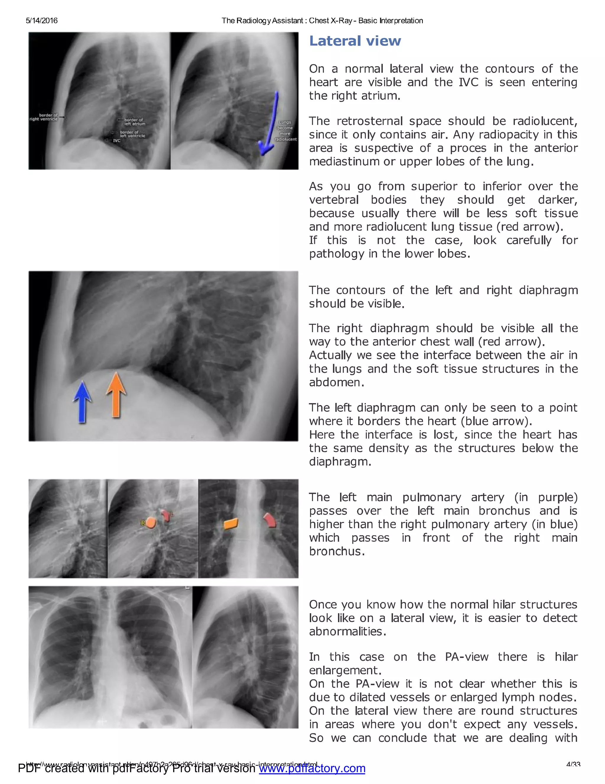 Chest x ray - basic interpretation | PDF