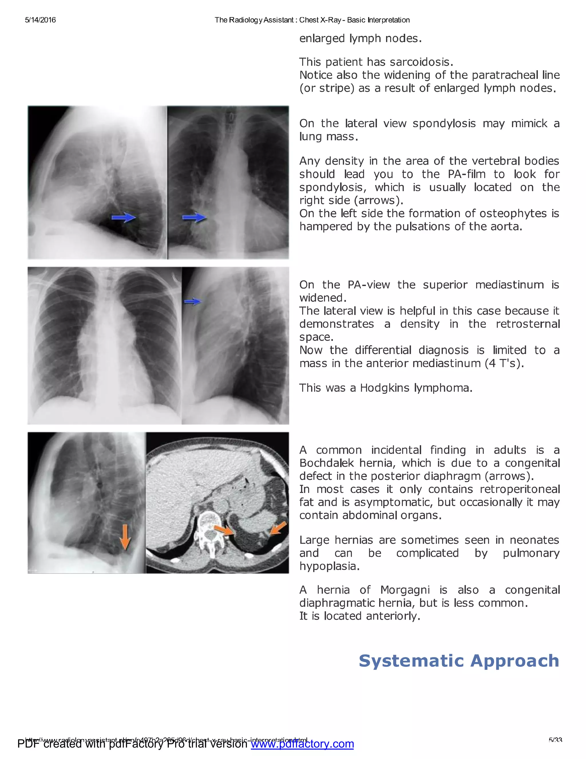 Chest x ray - basic interpretation | PDF