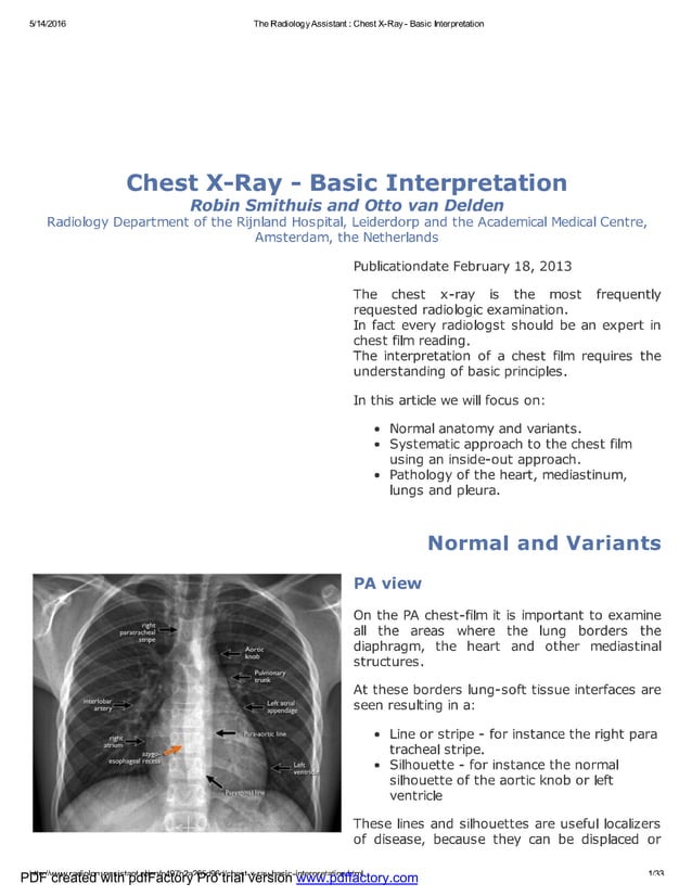 Chest x ray - basic interpretation | PDF
