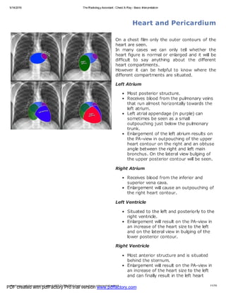 Chest x ray - basic interpretation | PDF