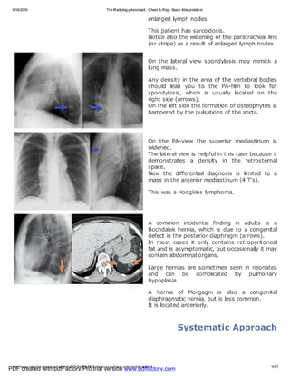 Chest x ray - basic interpretation | PDF