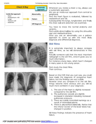 Chest x ray - basic interpretation | PDF