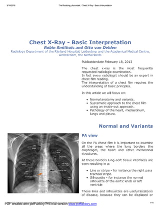 How To Read A Chest X-ray PDF: ABCDE Mnemonic, Step By Step, 56% OFF