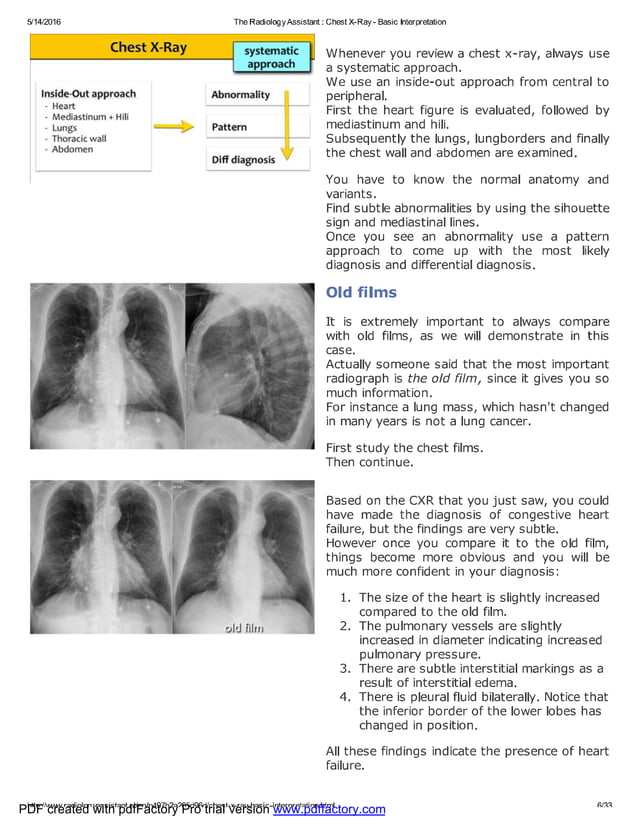 Chest x ray - basic interpretation