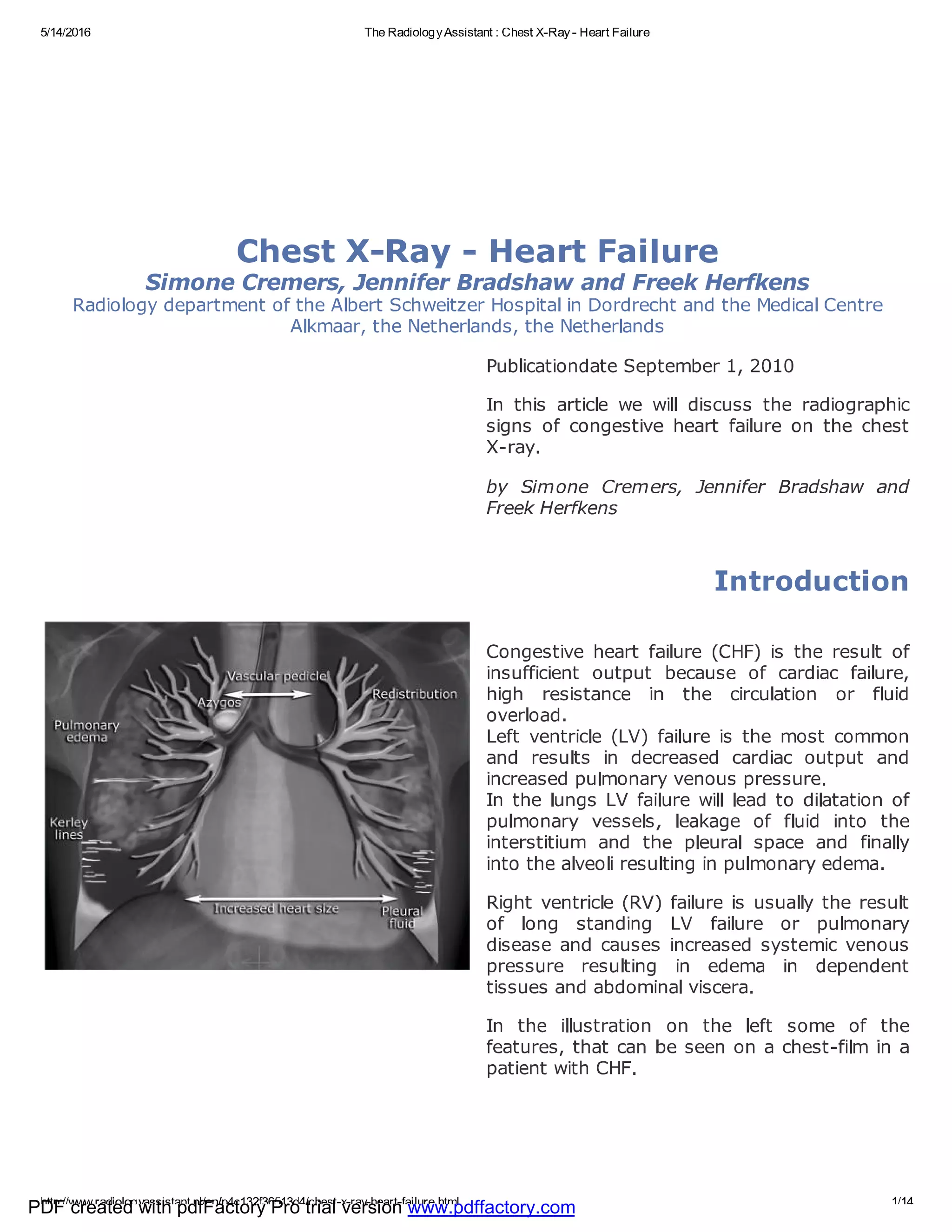 Chest x ray - heart failure | PDF