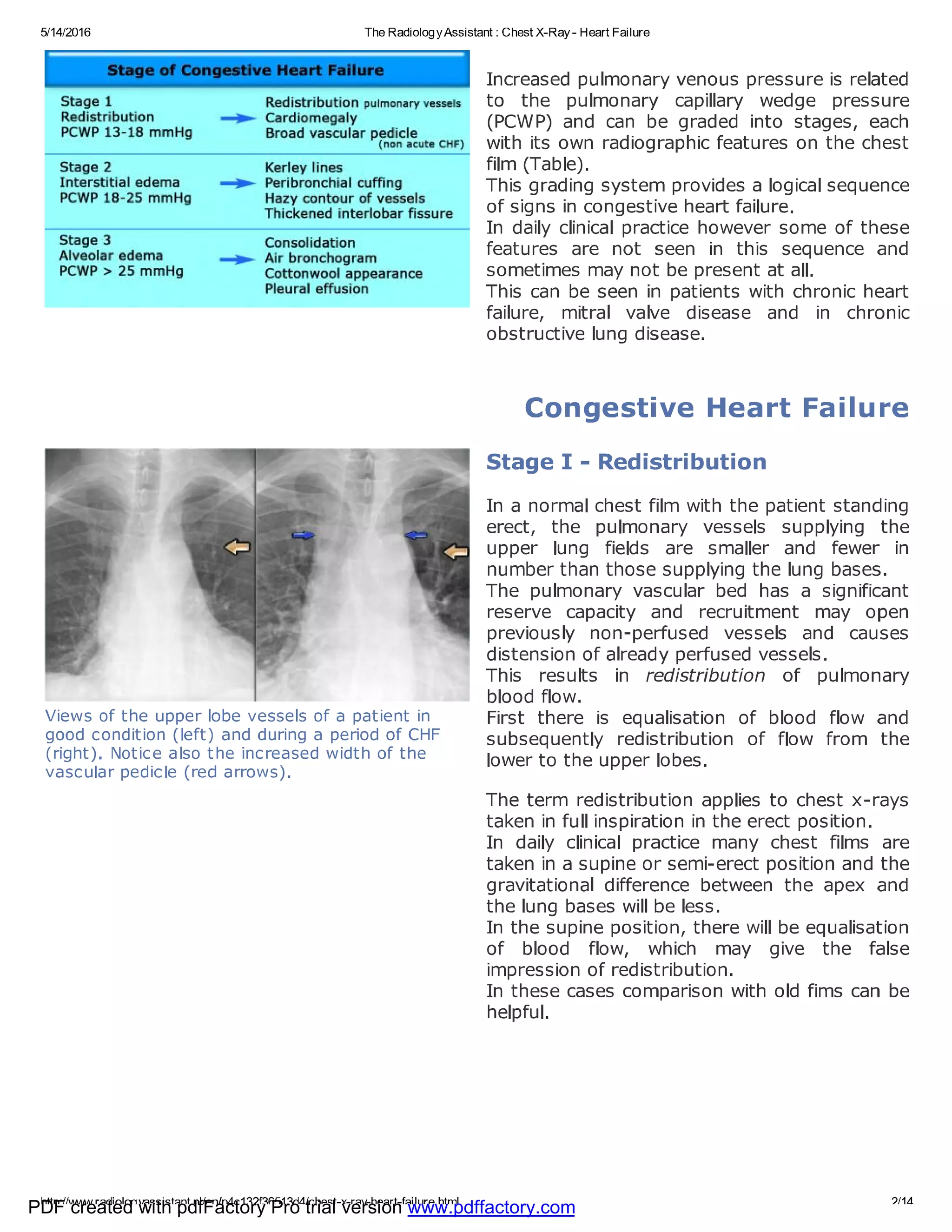 Chest x ray - heart failure | PDF