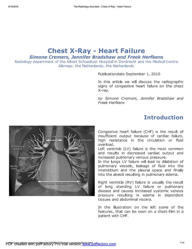 Chest x ray - heart failure | PDF
