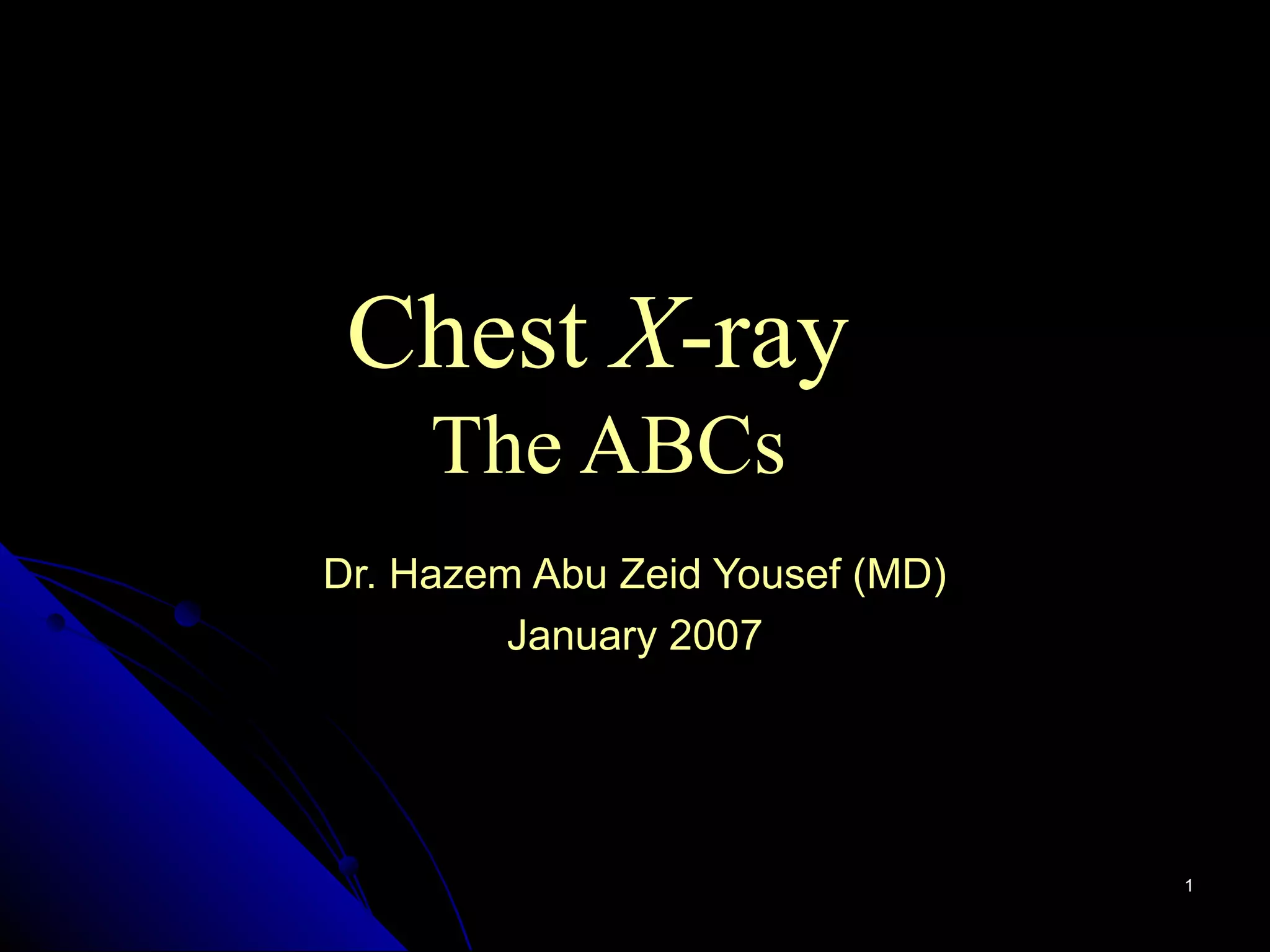 Chest X-ray for the undergraduate | PPT