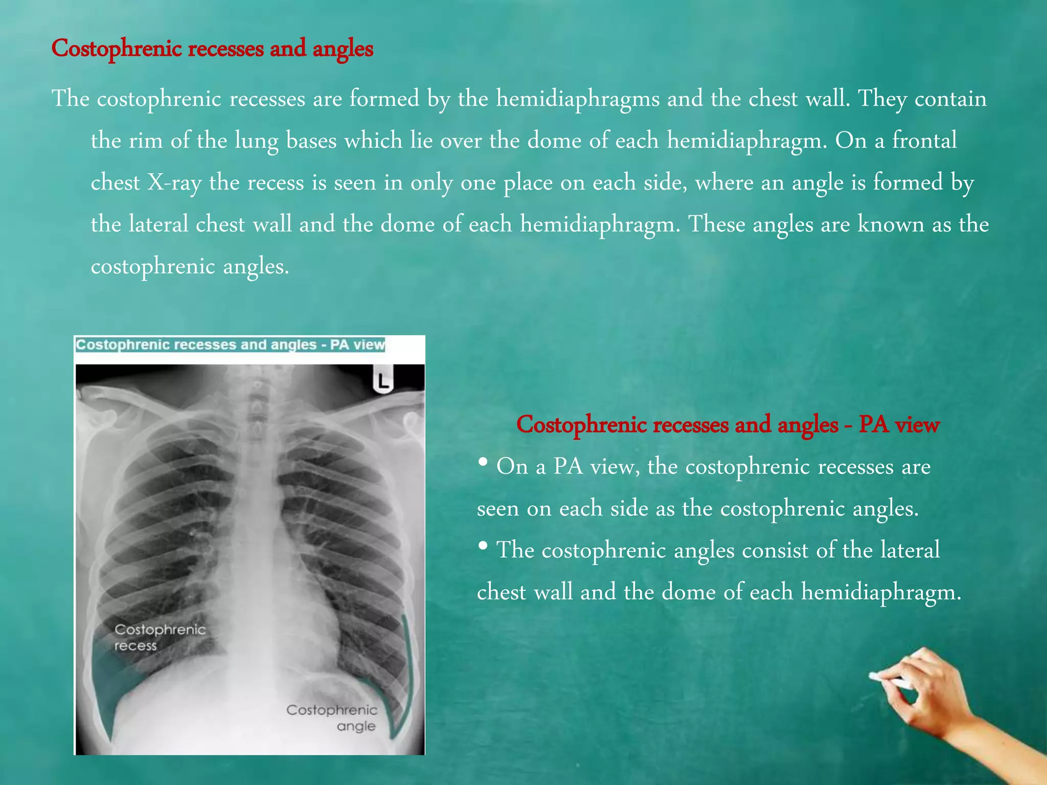 Chest x ray anatomy - how to interpret chest x-ray (2) | PPTX