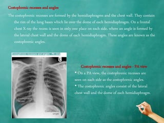 Chest x ray anatomy - how to interpret chest x-ray (2) | PPTX