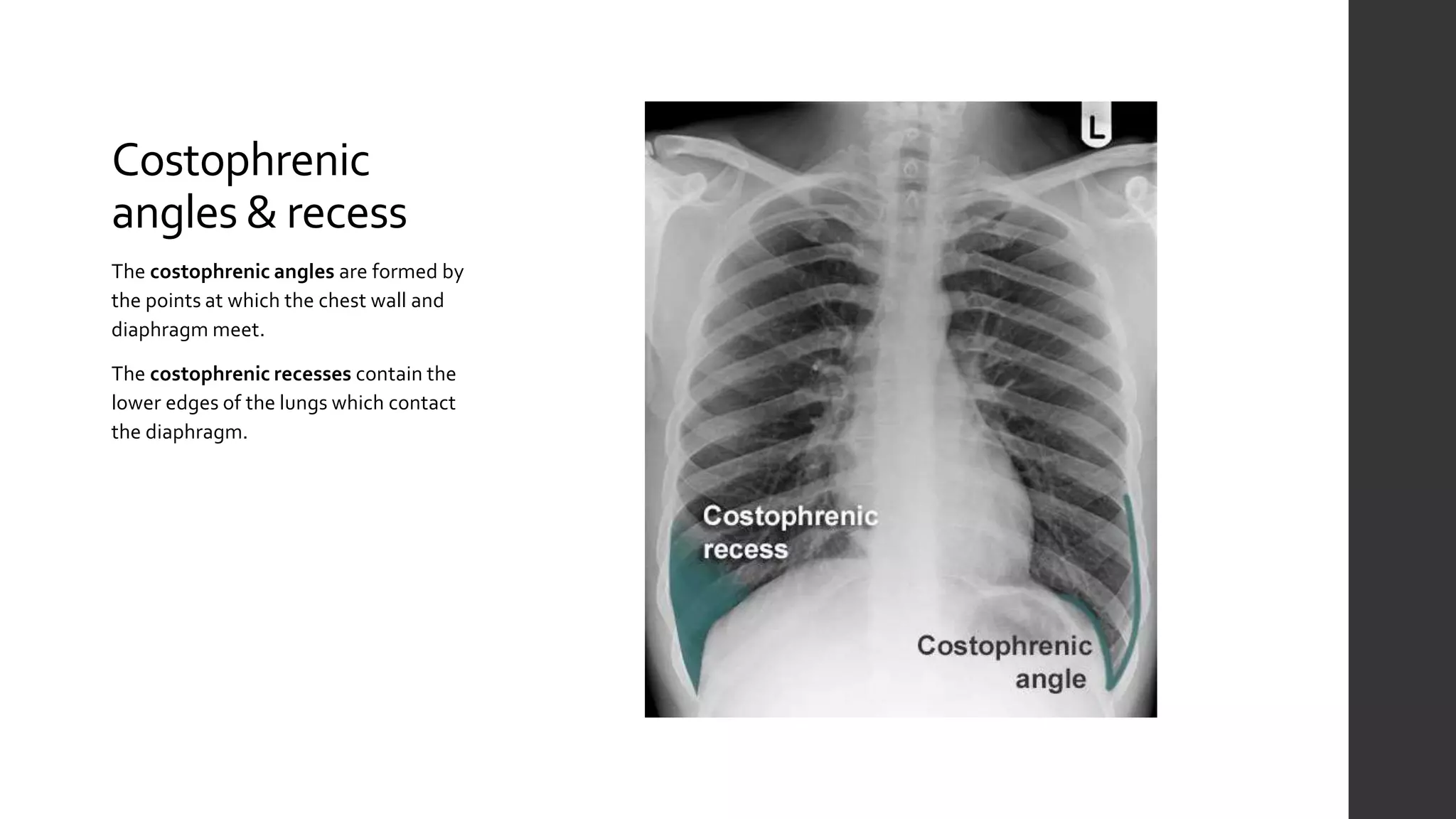 Chest X-ray: The Basics | PPTX