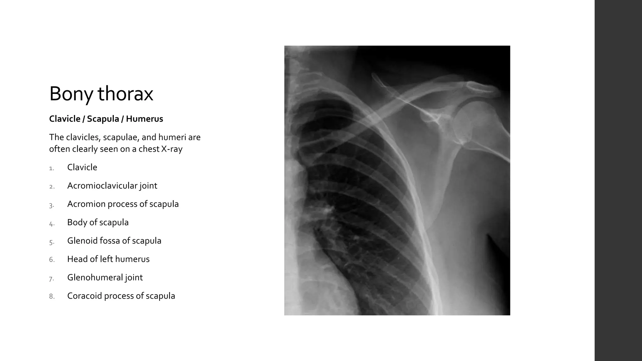 Chest X-ray: The Basics | PPTX
