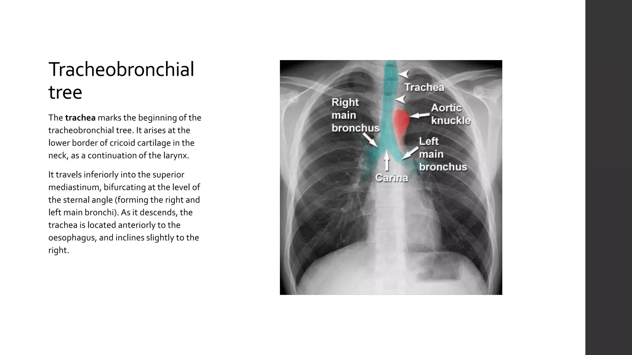 Chest X-ray: The Basics | PPTX