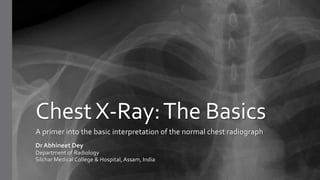 Chest X-ray: The Basics | PPTX