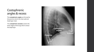 Chest X-ray: The Basics | PPTX