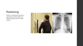 Chest X-ray: The Basics | PPTX