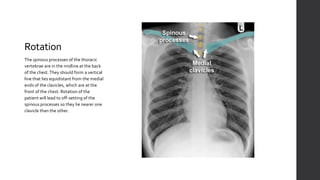 Chest X-ray: The Basics | PPTX