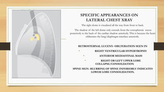 Chest X-ray basics approach, alveolar vs interstitial disease ...