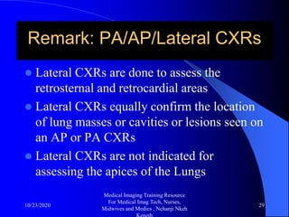 Chest x ray cxr and pathologies radiology training resource nchanji ...
