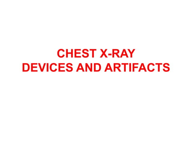 CHEST X-RAY DEVICES AND ARTIFACTS pptx.pptx